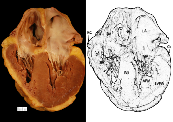 e-heart.org Cardiovascular Pathology Home Page