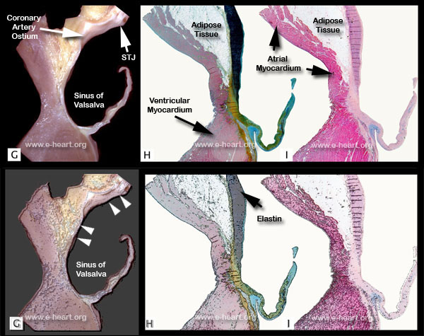 e-heart.org Cardiovascular Pathology Home Page