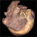 e-heart.org Cardiovascular Pathology Home Page