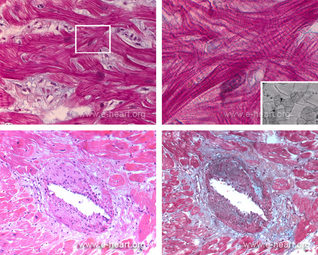 e-heart.org Cardiovascular Pathology Home Page