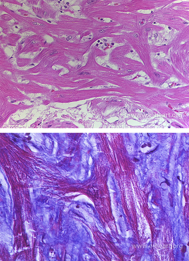 e-heart.org Cardiovascular Pathology Home Page