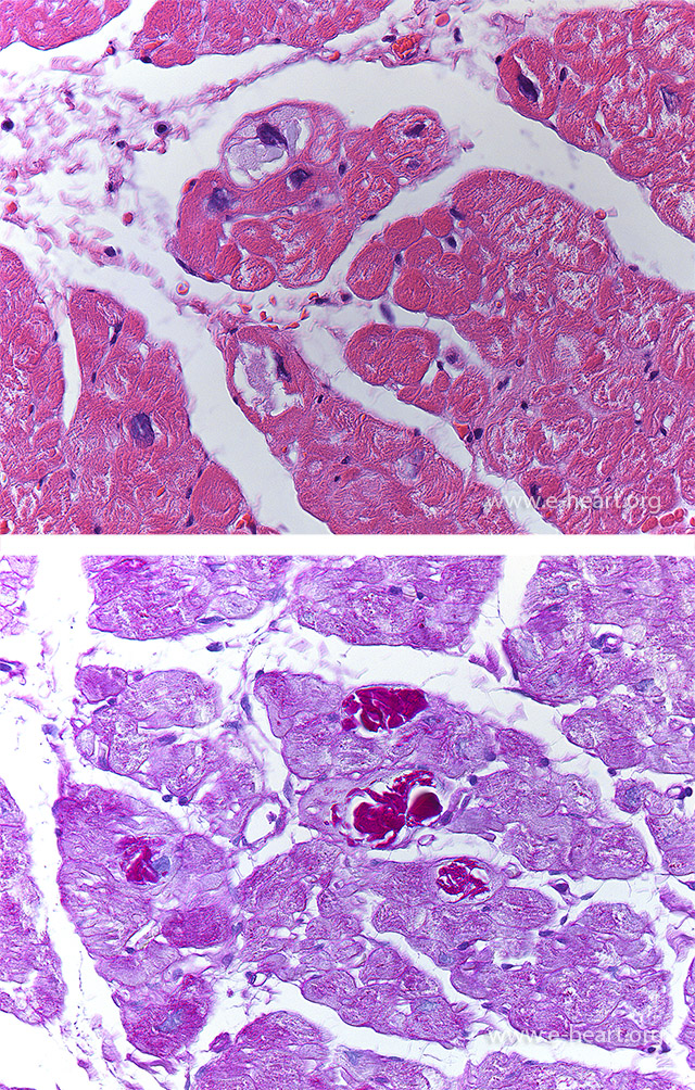 e-heart.org Cardiovascular Pathology Home Page