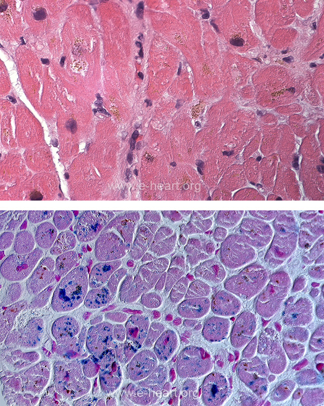 e-heart.org Cardiovascular Pathology Home Page