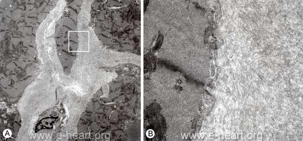 e-heart.org Cardiovascular Pathology Home Page
