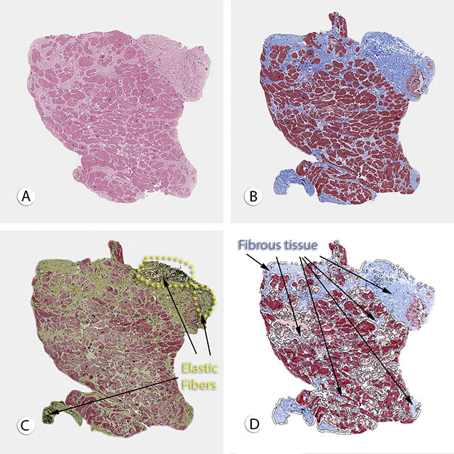 e-heart.org Cardiovascular Pathology Home Page