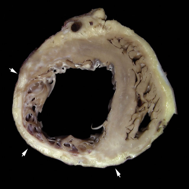 e-heart.org Cardiovascular Pathology Home Page