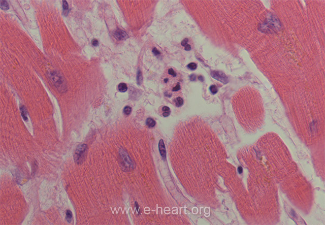 e-heart.org Cardiovascular Pathology Home Page