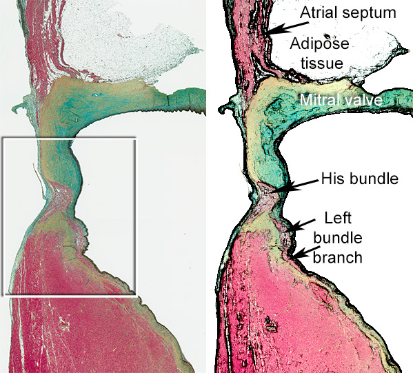 e-heart.org Cardiovascular Pathology Home Page