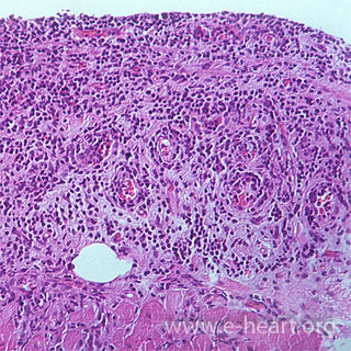 e-heart.org Cardiovascular Pathology Home Page