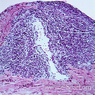e-heart.org Cardiovascular Pathology Home Page