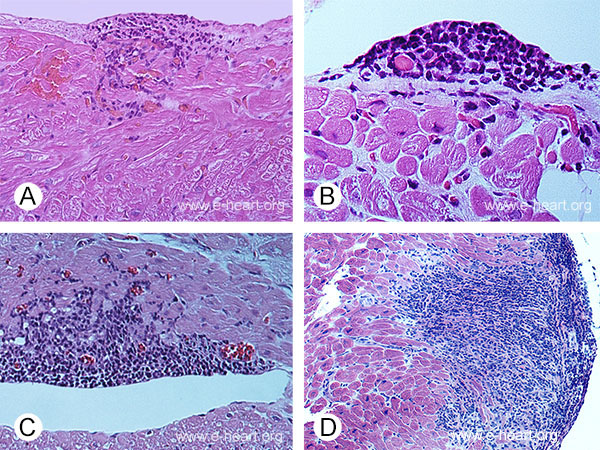 e-heart.org Cardiovascular Pathology Home Page