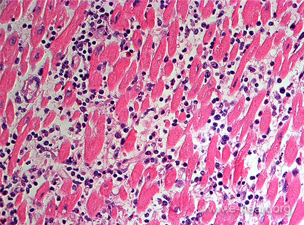 e-heart.org Cardiovascular Pathology Home Page