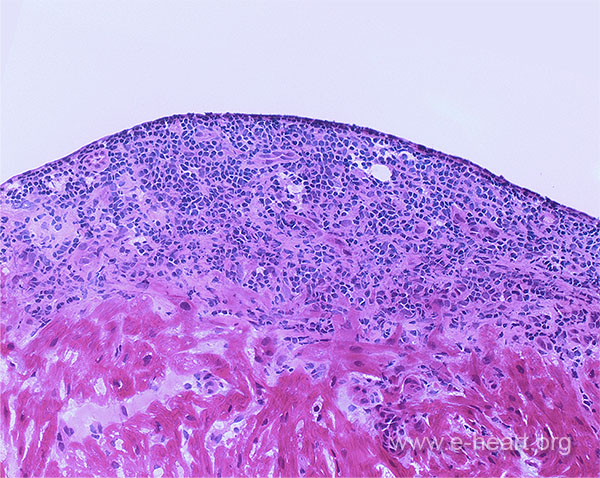 e-heart.org Cardiovascular Pathology Home Page