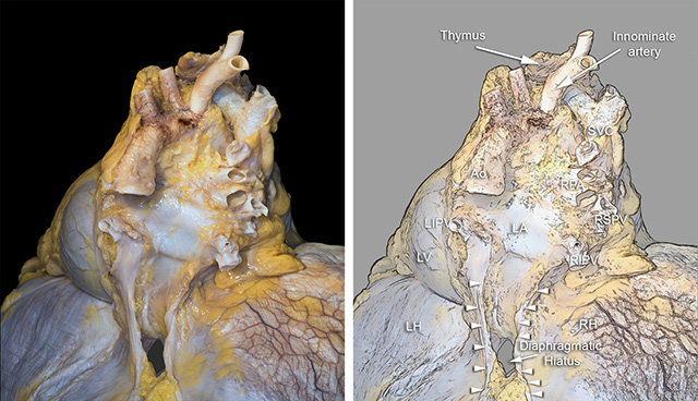 e-heart.org Cardiovascular Pathology Home Page