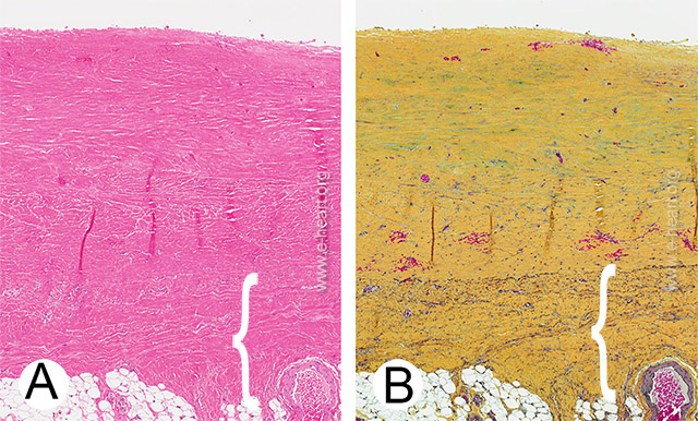 e-heart.org Cardiovascular Pathology Home Page