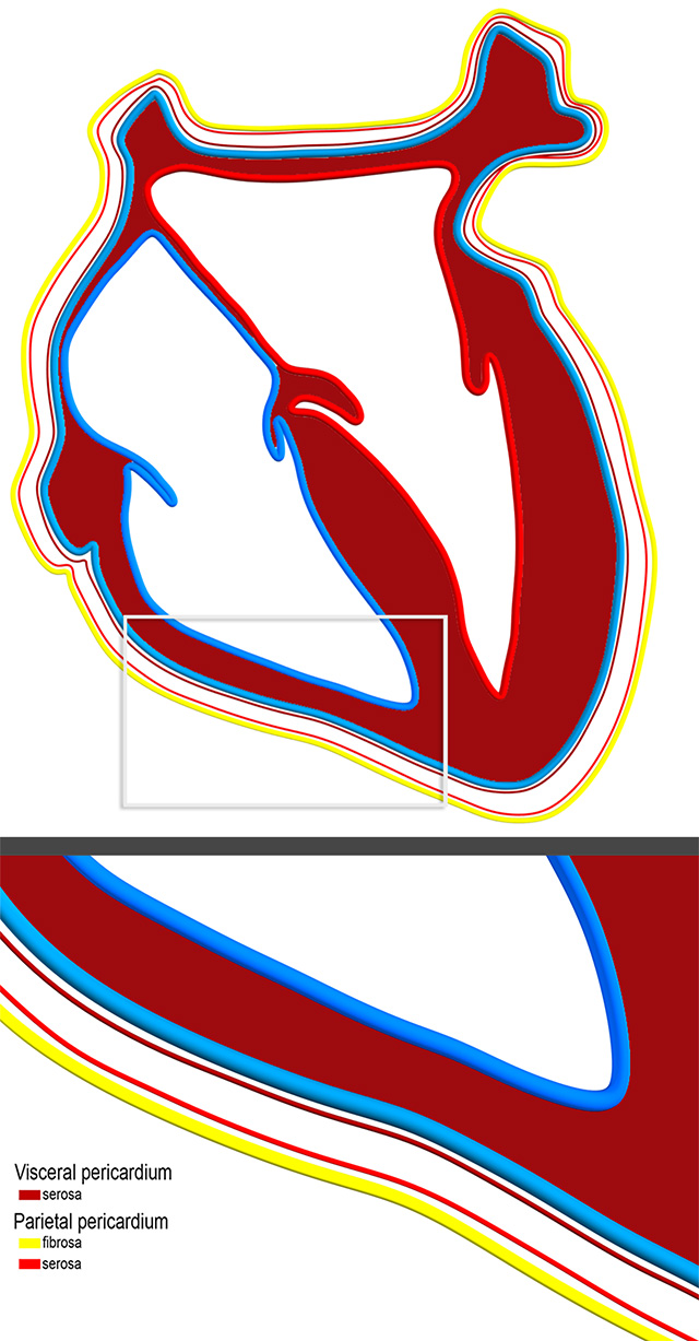 e-heart.org Cardiovascular Pathology Home Page