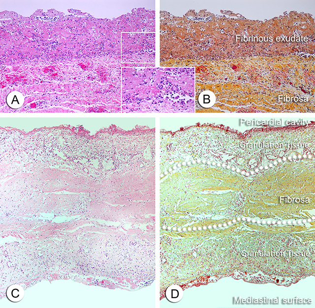 e-heart.org Cardiovascular Pathology Home Page