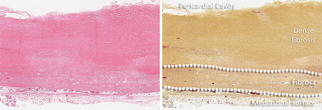 e-heart.org Cardiovascular Pathology Home Page