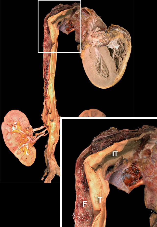 e-heart.org Cardiovascular Pathology Home Page