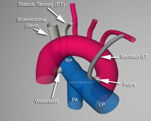 e-heart.org Cardiovascular Pathology Home Page